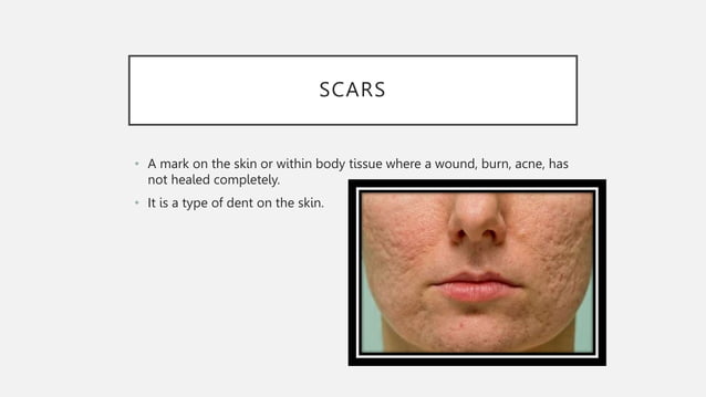 sKIN CONDITIONs.pptx