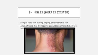 sKIN CONDITIONs.pptx