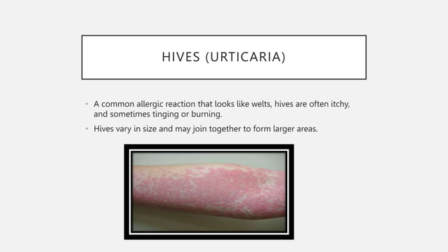 sKIN CONDITIONs.pptx