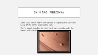 sKIN CONDITIONs.pptx