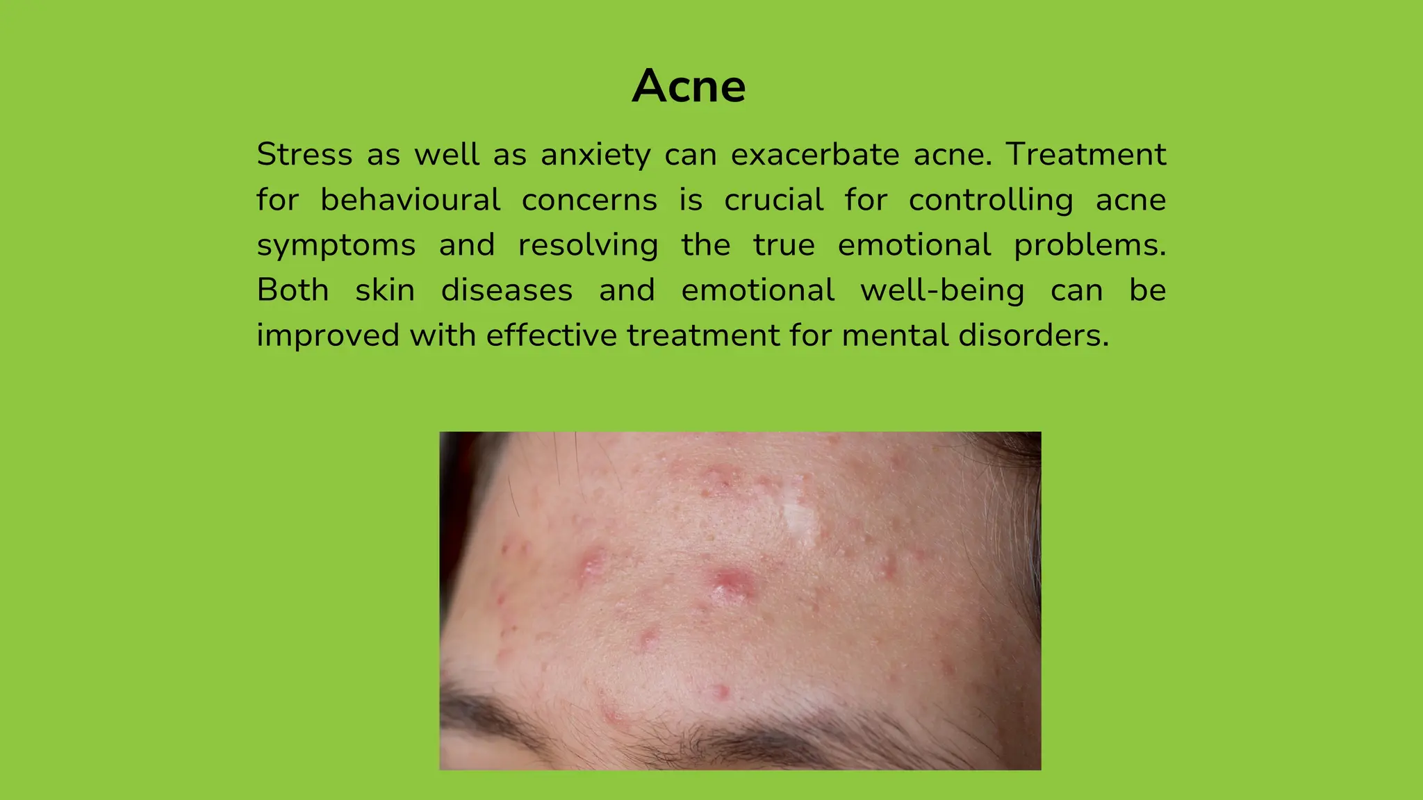 Skin conditions are associated with mental health issues. | PDF