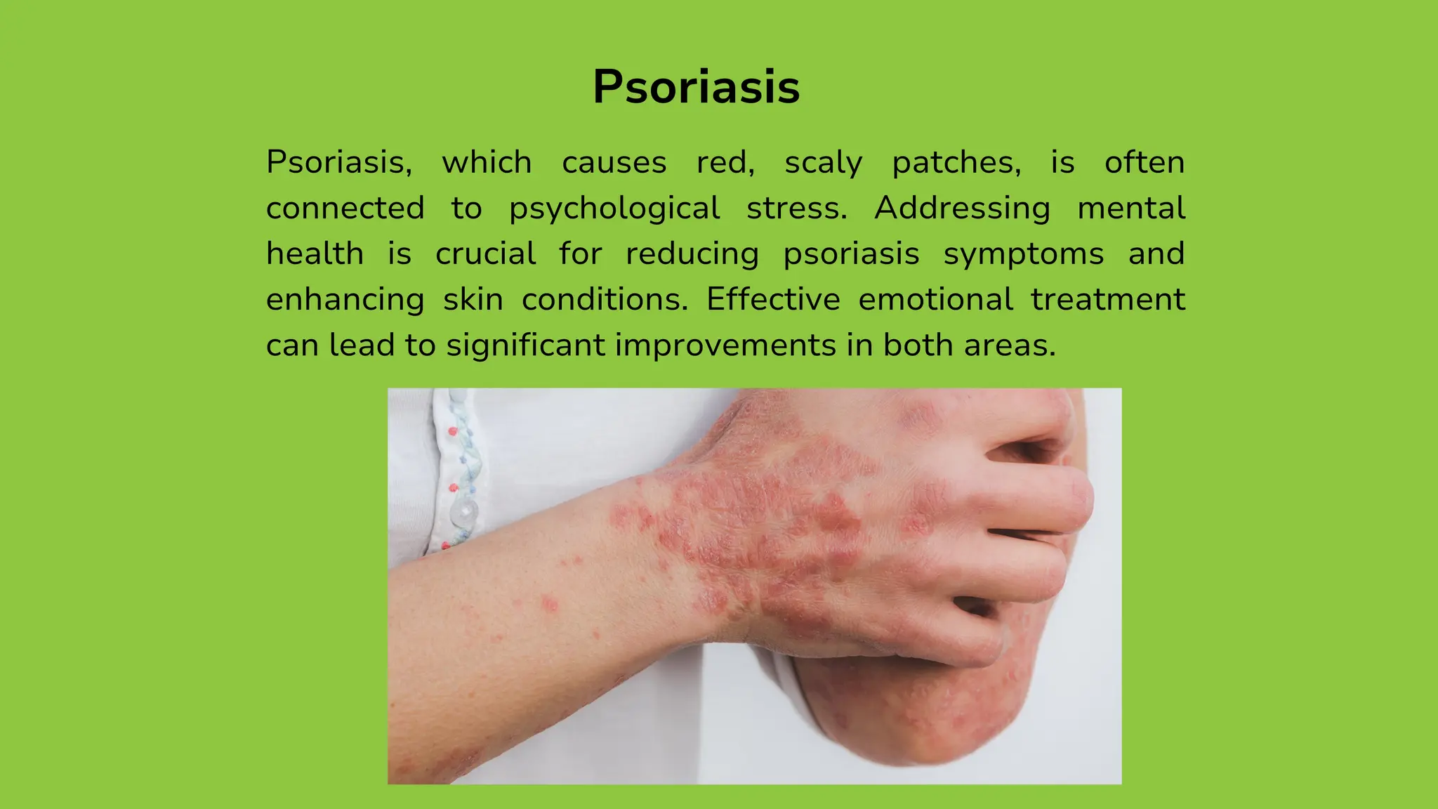 Skin conditions are associated with mental health issues. | PDF
