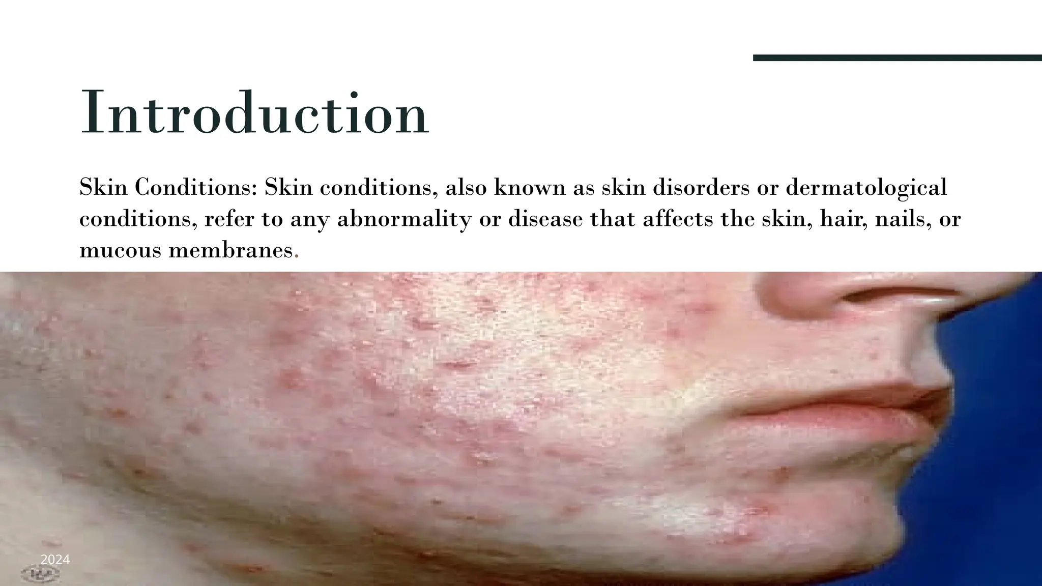 Skin Conditions presentation Mutinta.pptx