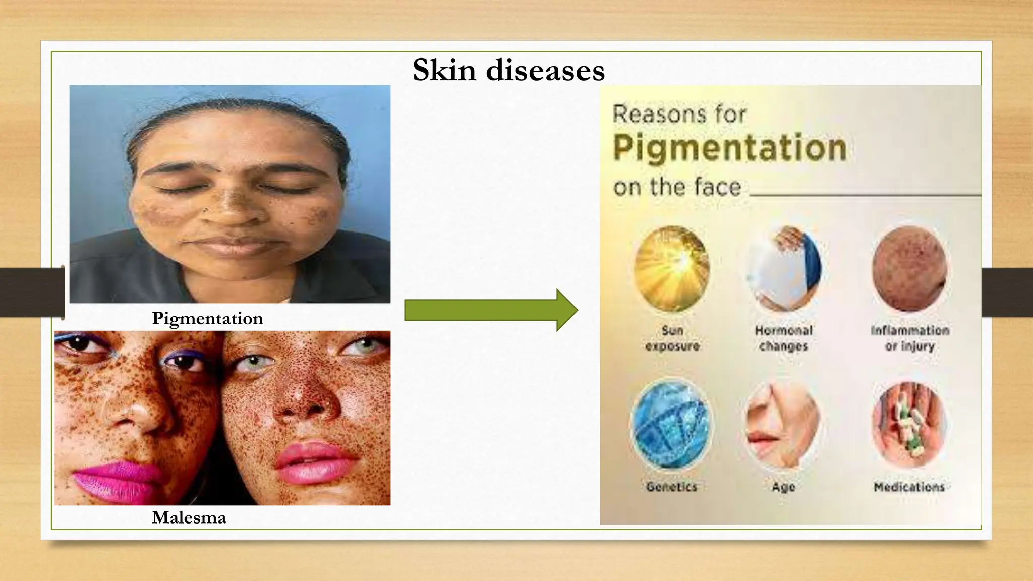 Human Skin, physiology, skin types, skin disease and skin cure. Take a ...