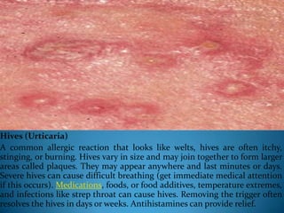 Health News | PPSX
