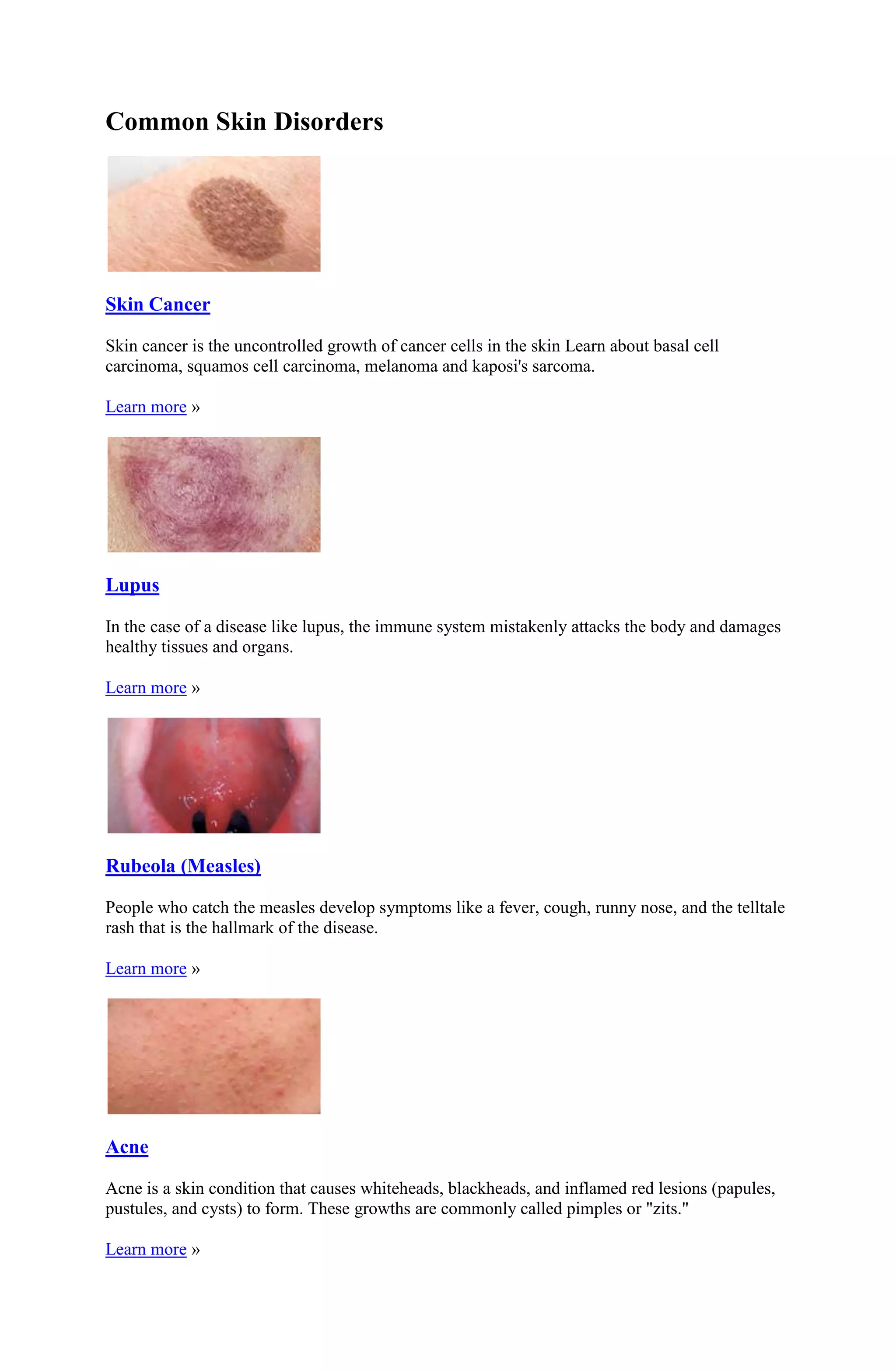 Skin desease | DOCX