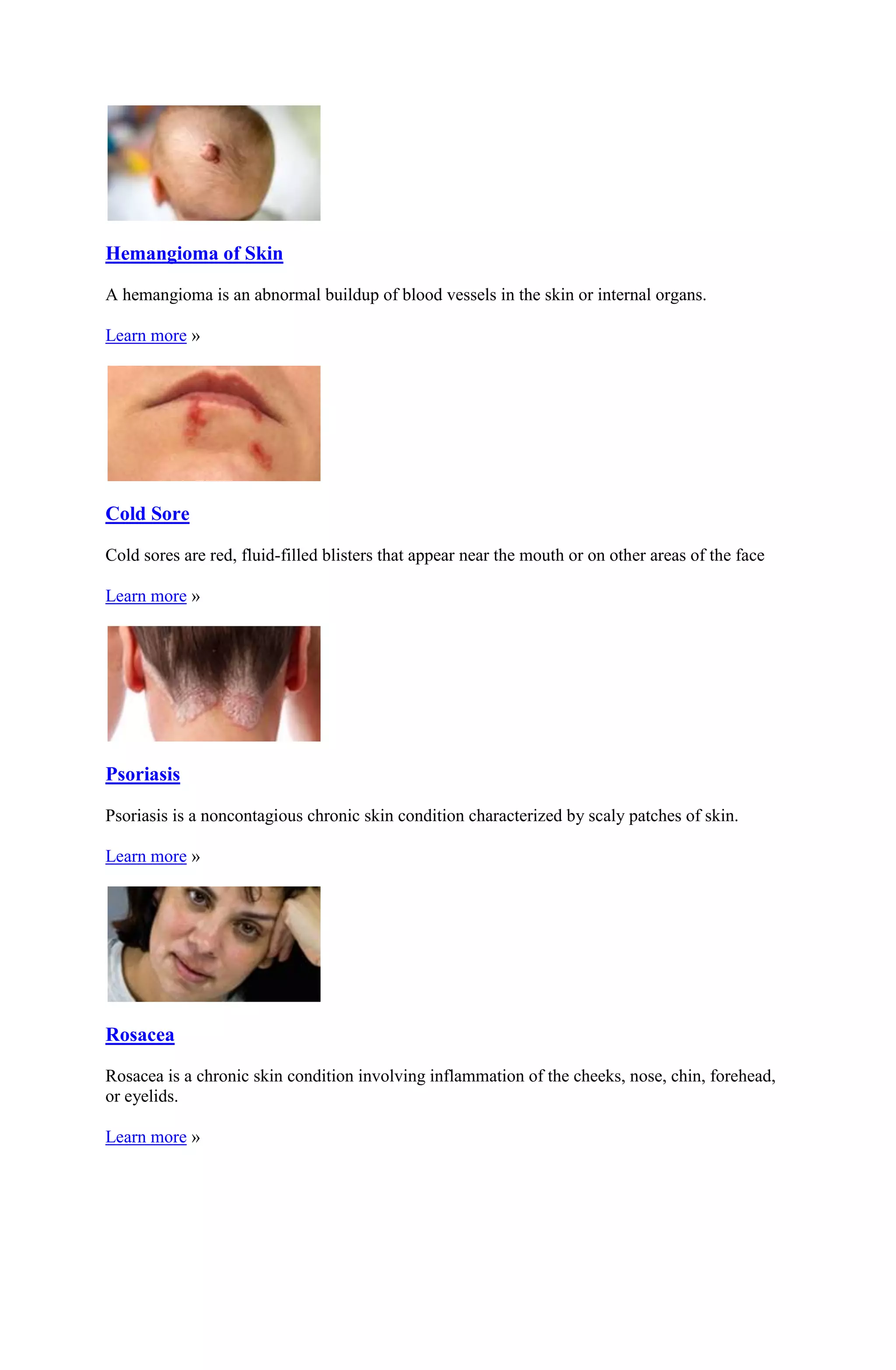 Skin desease | DOCX