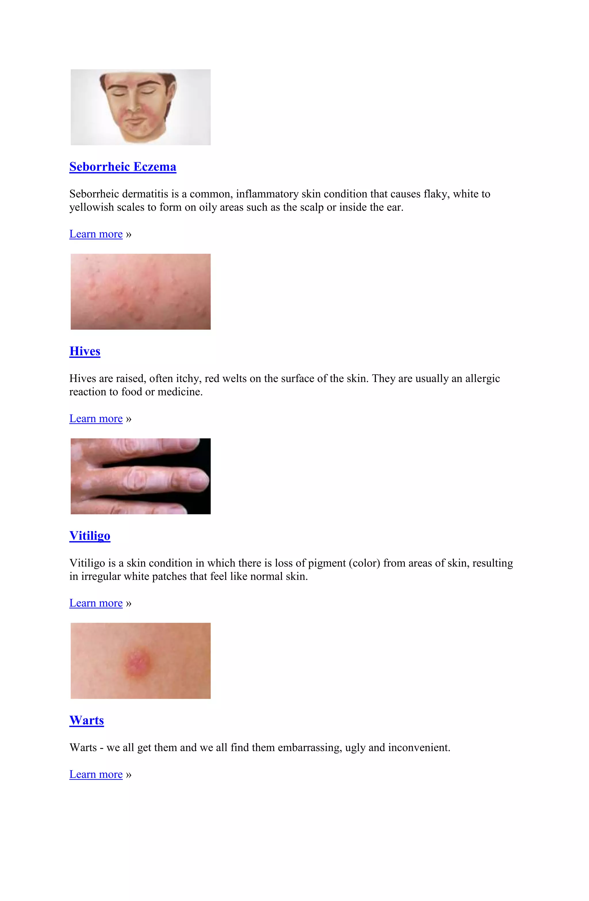 Skin desease | DOCX