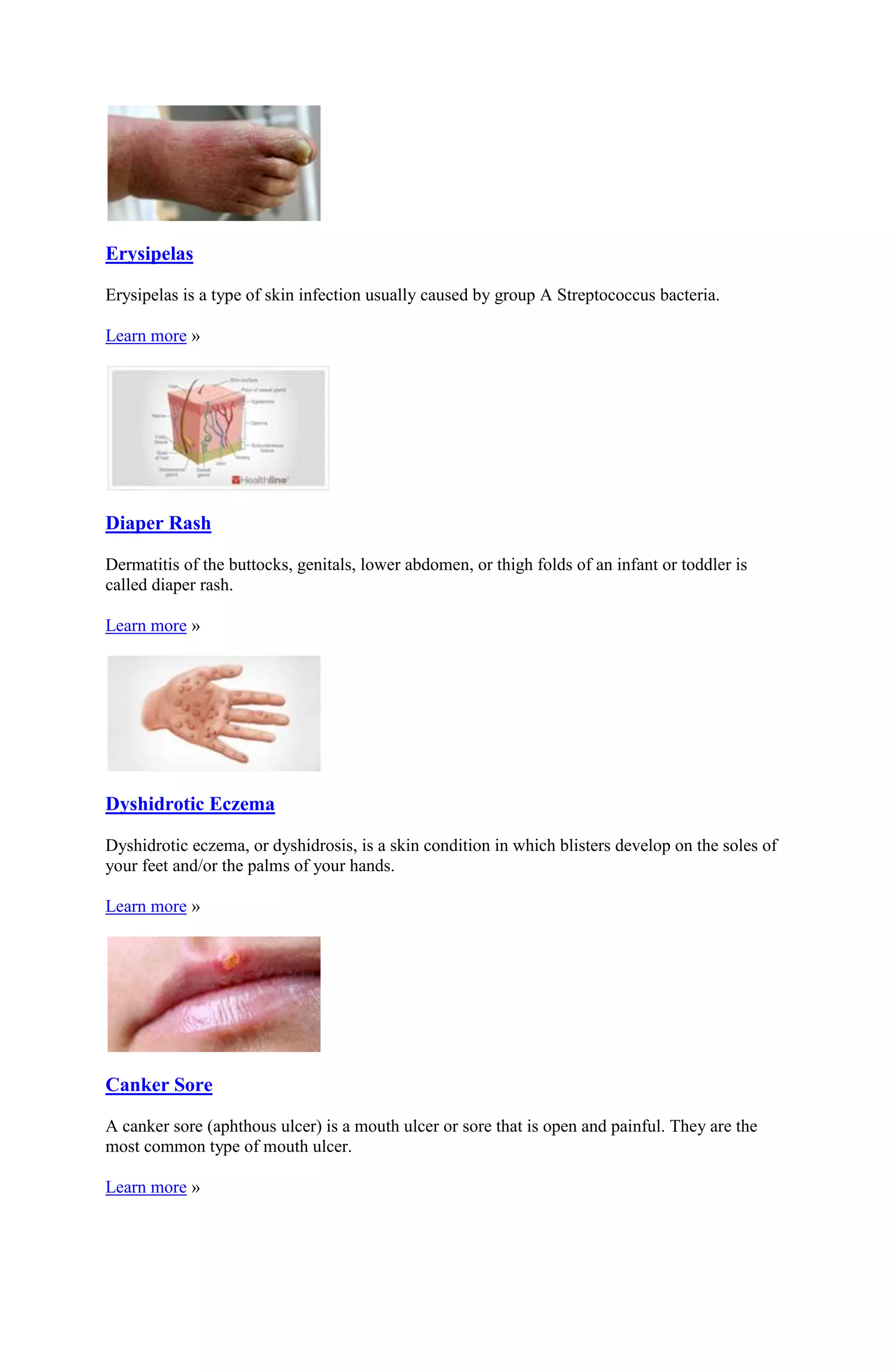 Skin desease | DOCX