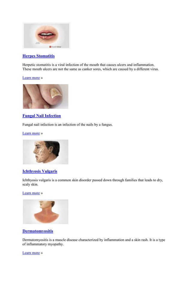 Skin desease | DOCX | Skin and Dermatology | Diseases and Conditions