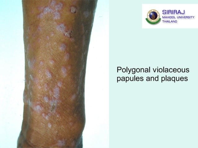 Skin Diseases that mostly affect us.pptx