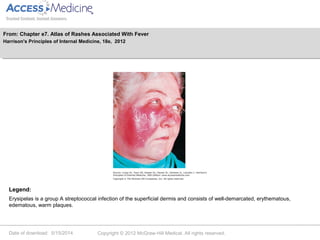 Skin disease for internist | PPT