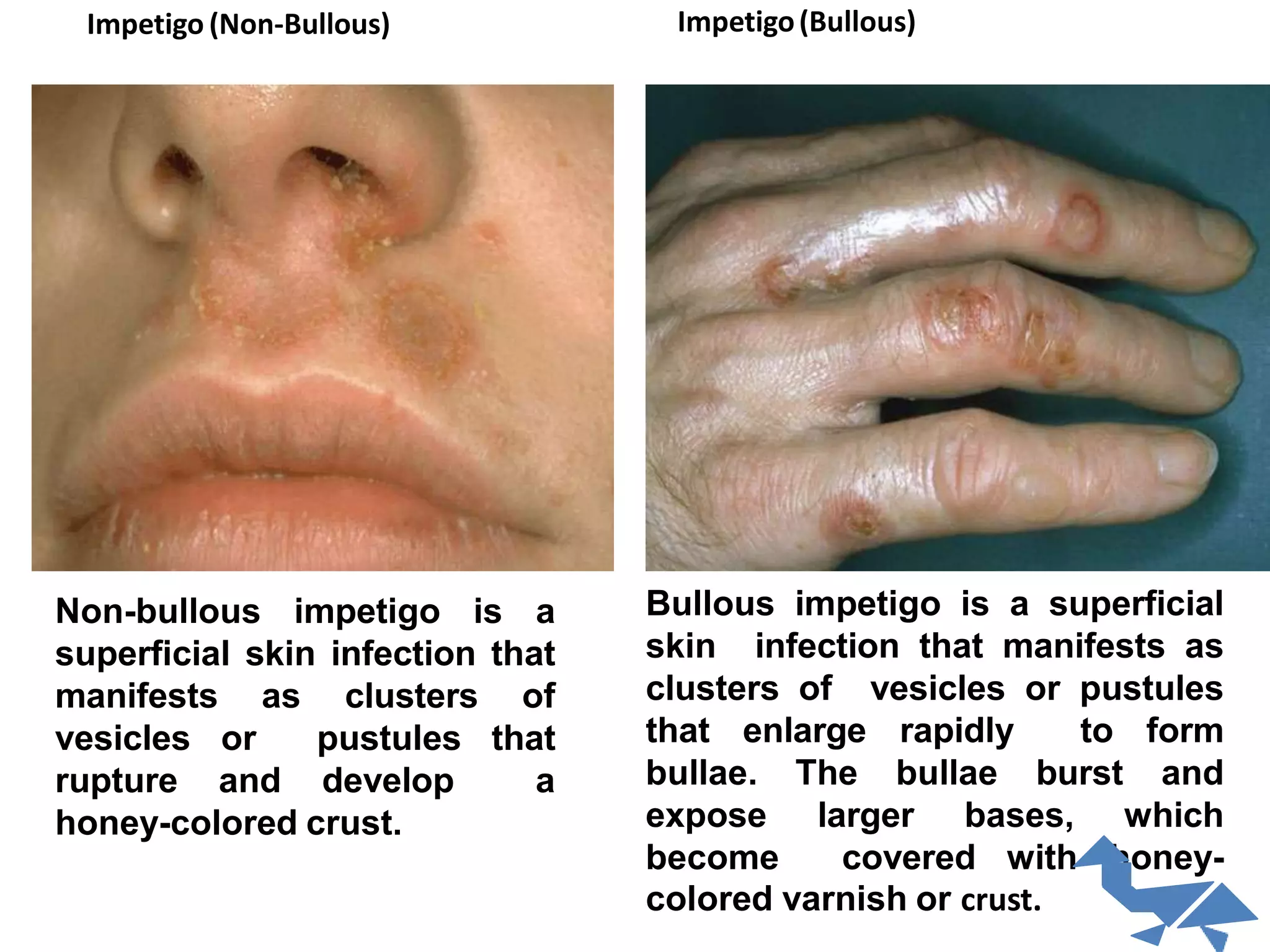 Skin disease ppt for nursing student | PPTX