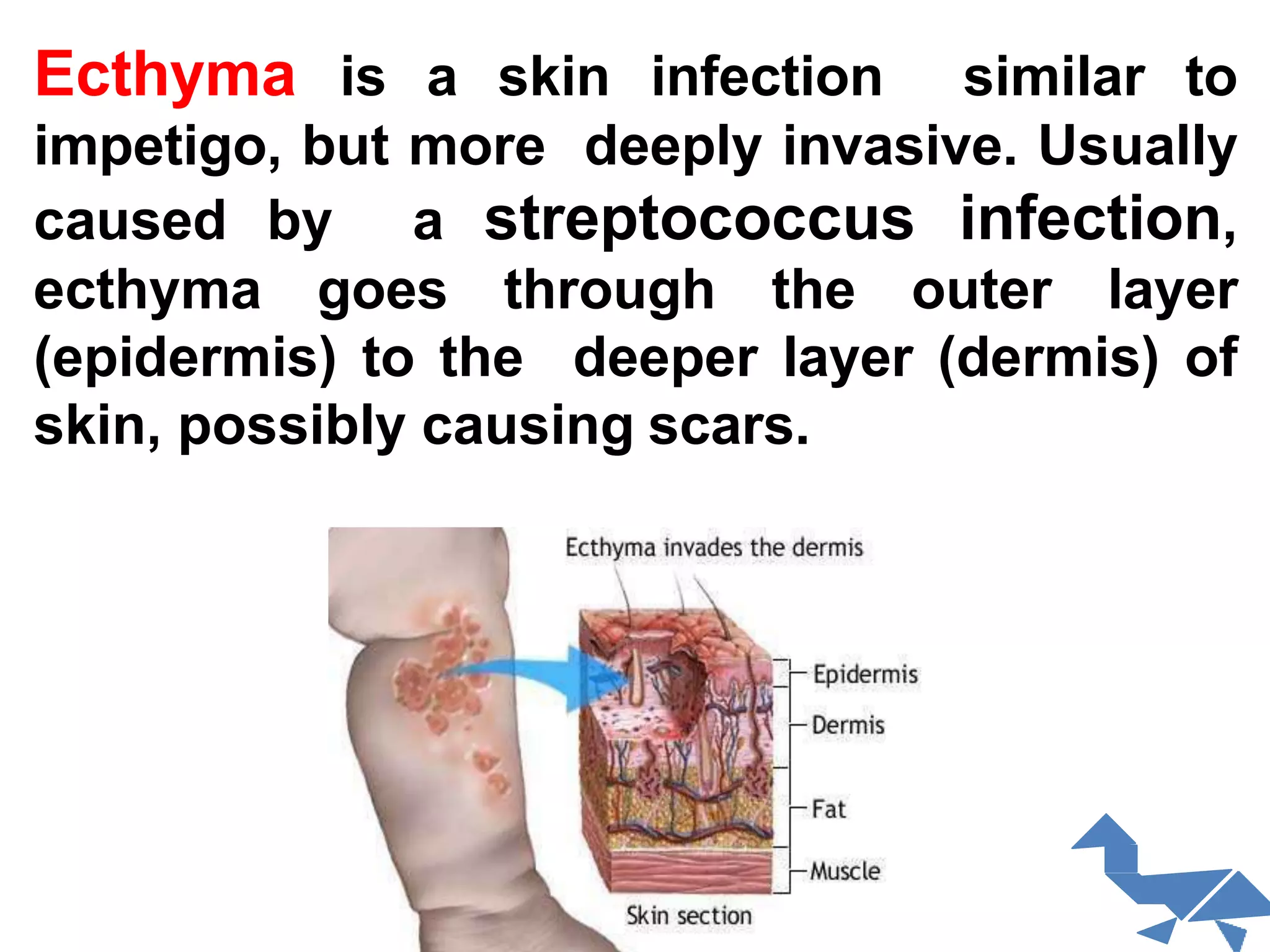 Skin disease ppt for nursing student | PPTX