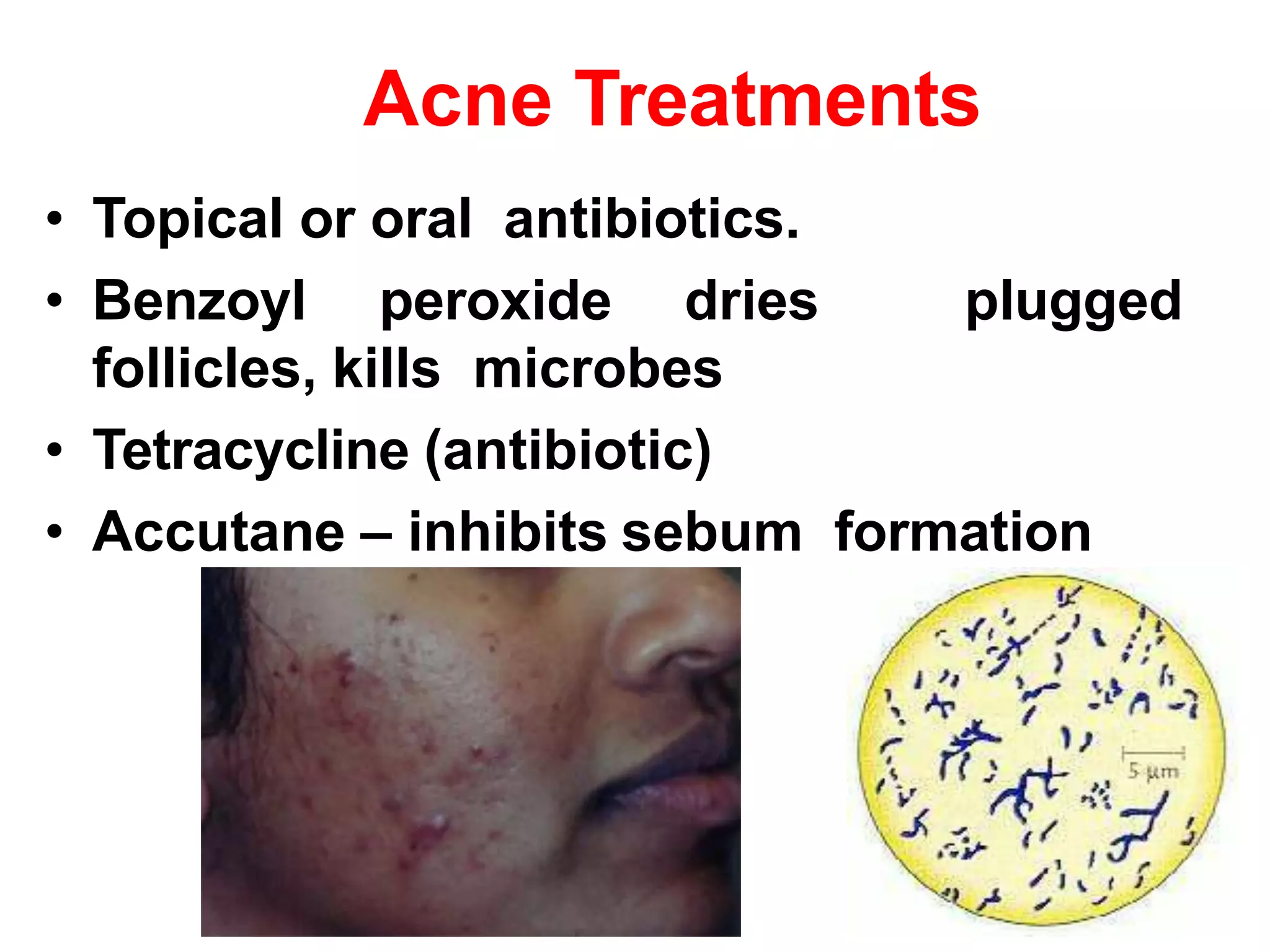 Skin disease ppt for nursing student | PPTX
