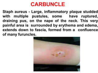 Skin disease ppt for nursing student | PPTX