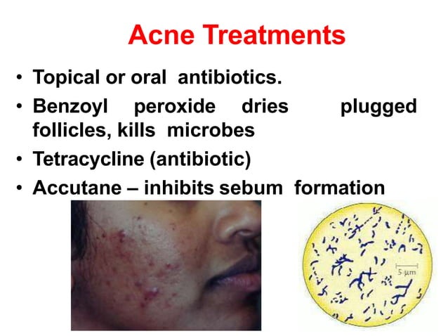 Skin disease ppt for nursing student | PPTX