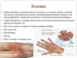 skin diseases.pptx