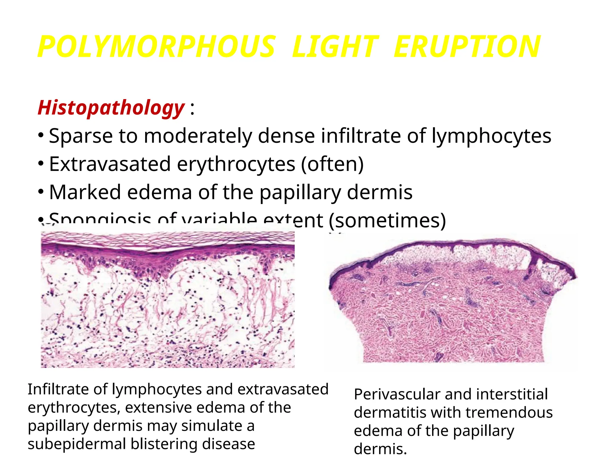 Common entities of dermatopathology of human | PPTX