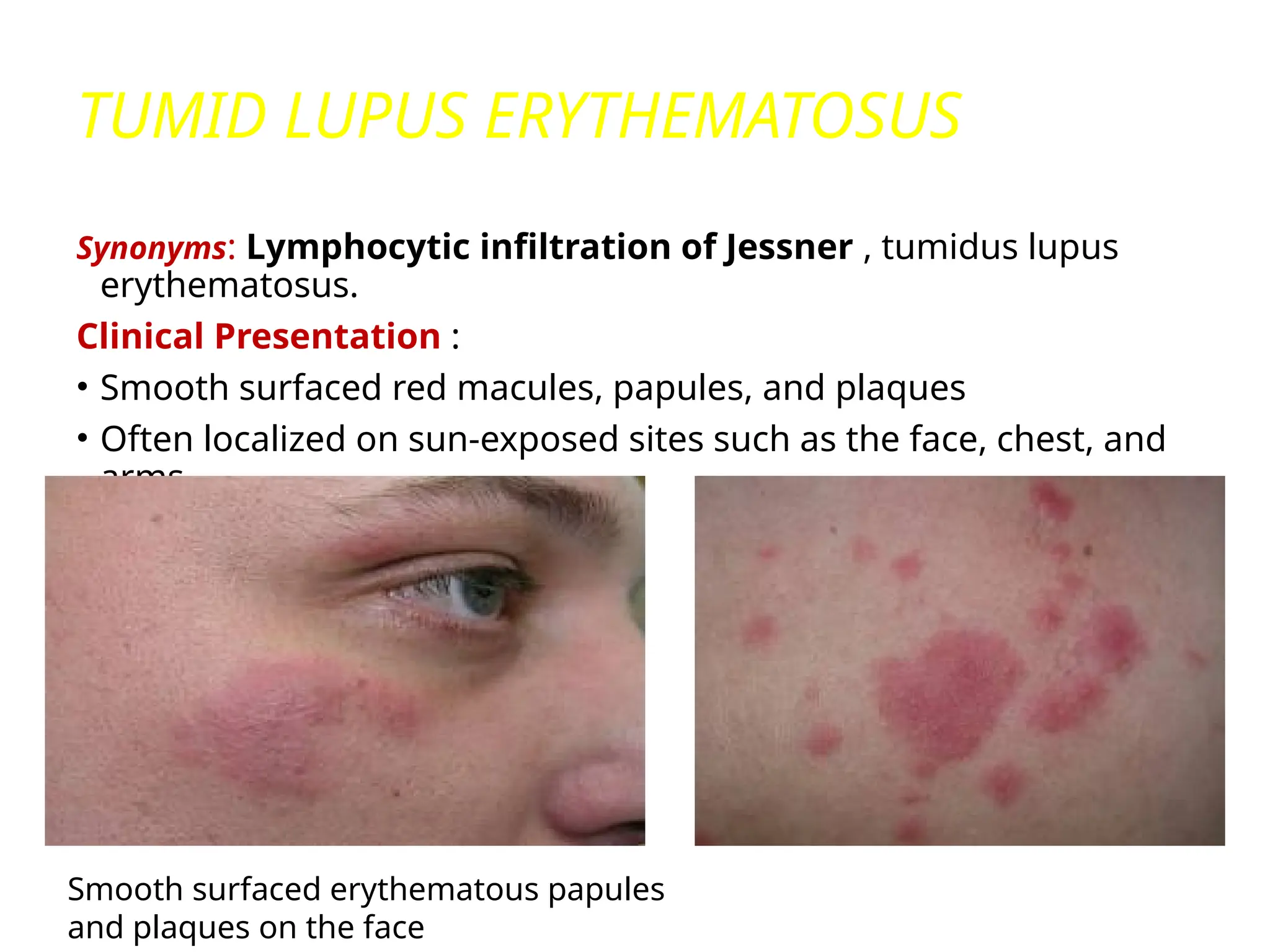 Common entities of dermatopathology of human | PPTX
