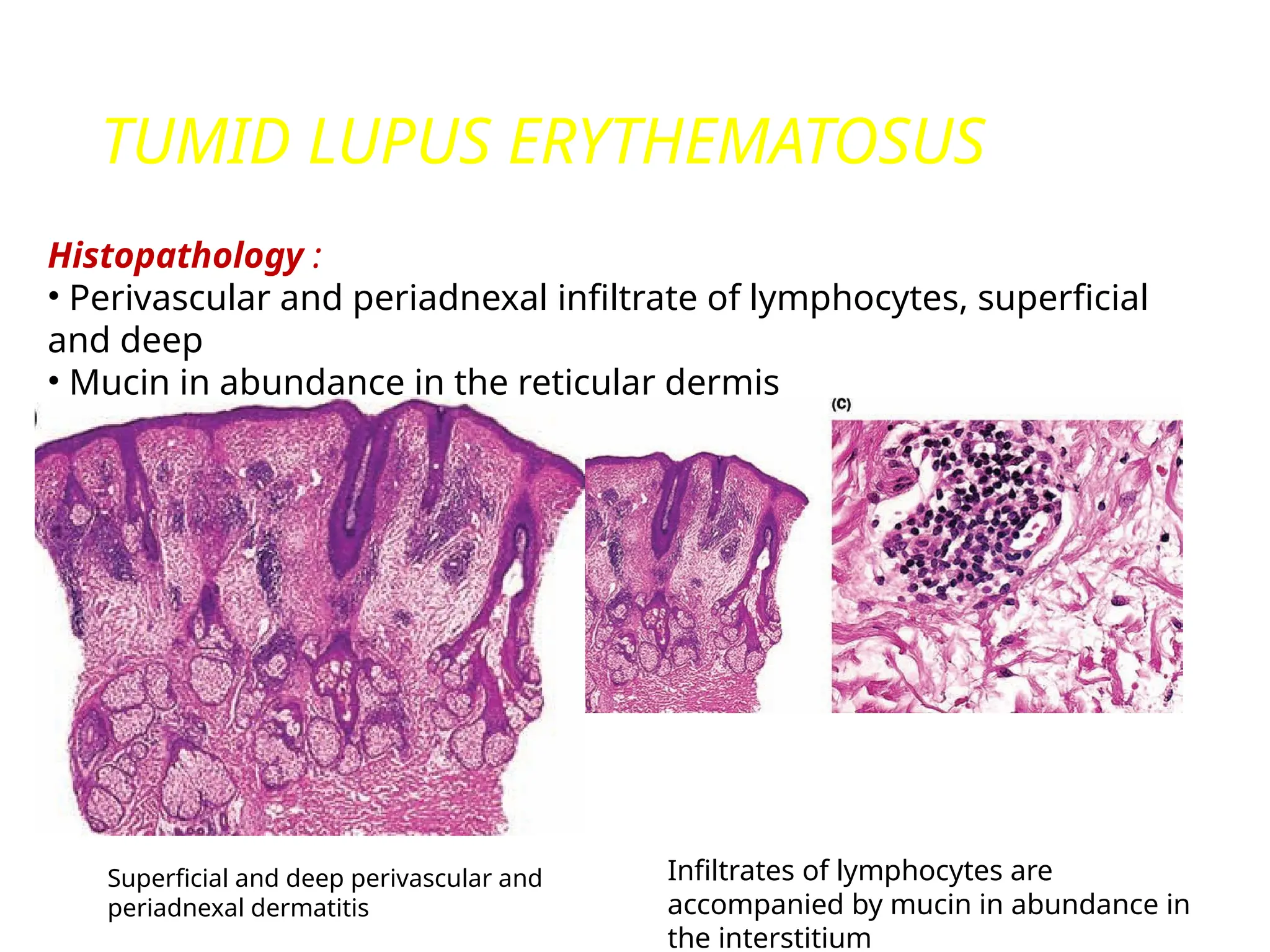 Common entities of dermatopathology of human | PPTX