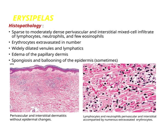 Common entities of dermatopathology of human | PPTX