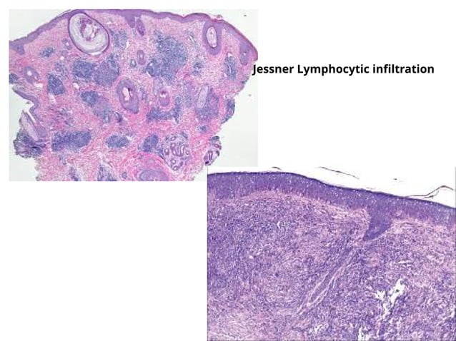 Common entities of dermatopathology of human | PPTX