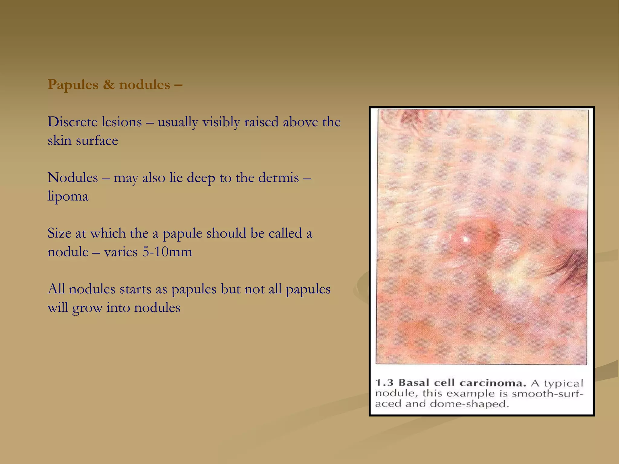 SKIN DISEASES and more.ppt