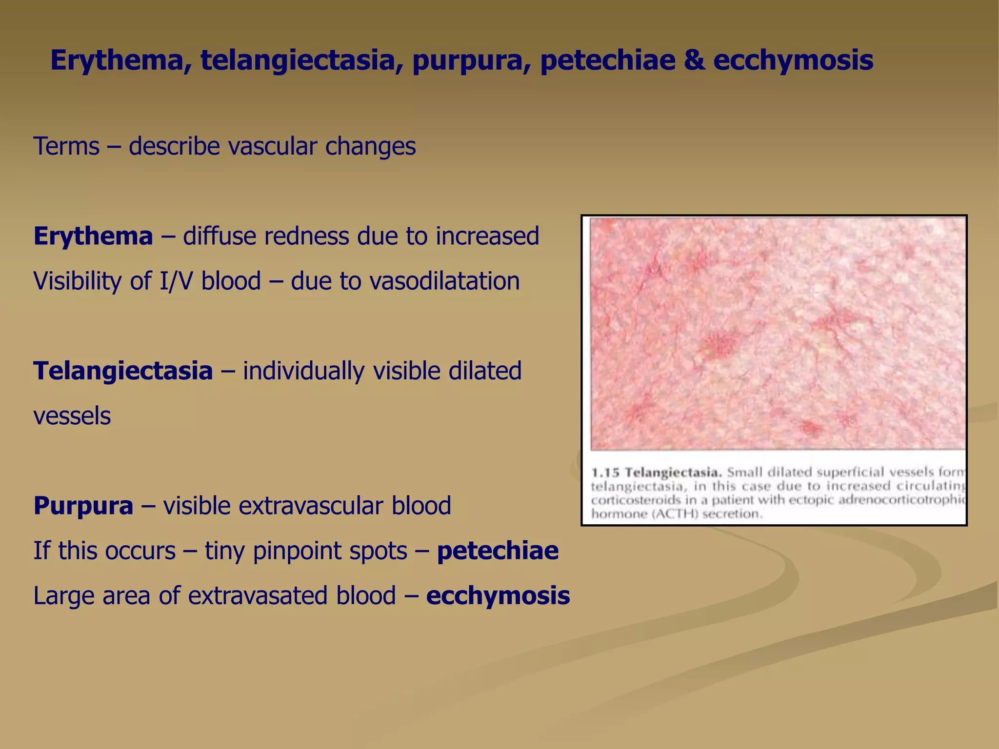 SKIN DISEASES and more.ppt