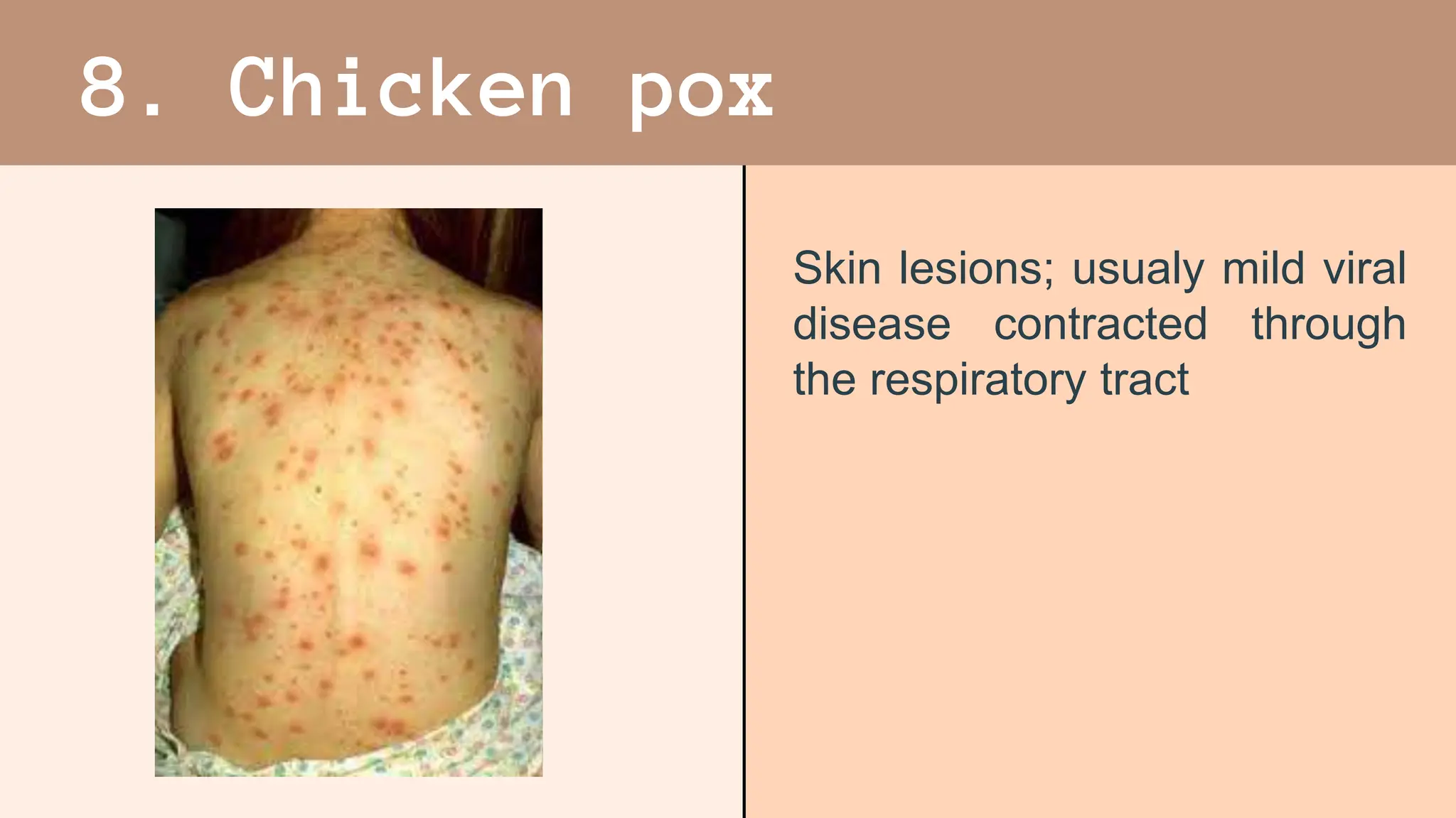 skin diseases, disorders, and prevention.pptx