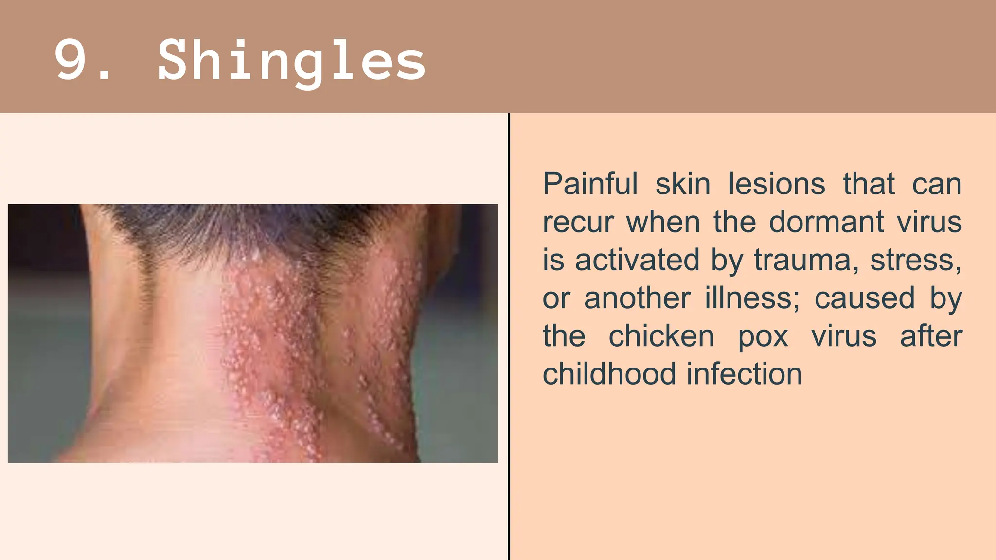 skin diseases, disorders, and prevention.pptx