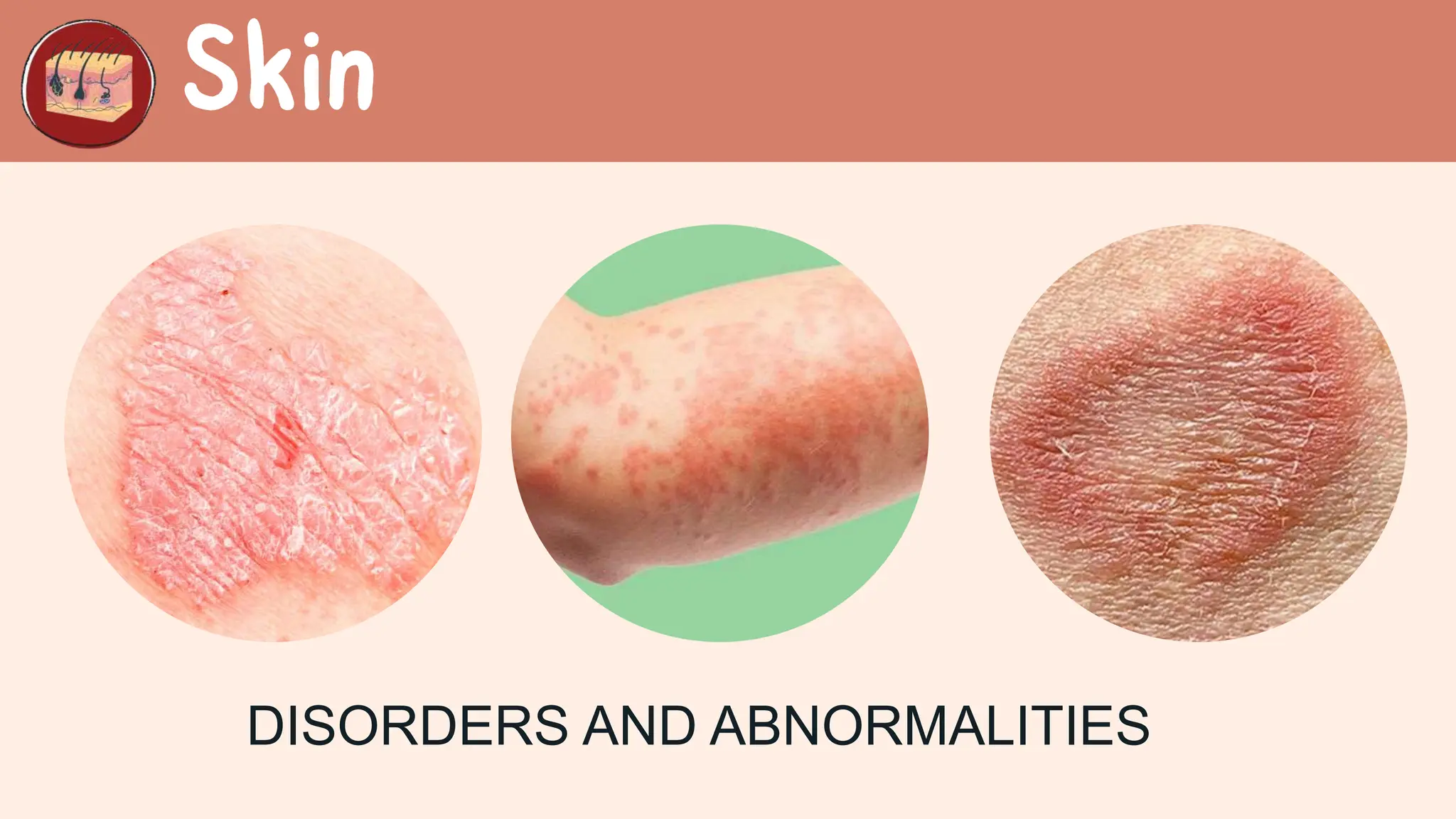skin diseases, disorders, and prevention.pptx