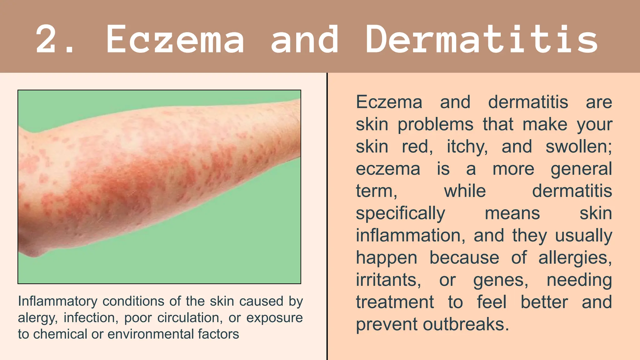 skin diseases, disorders, and prevention.pptx