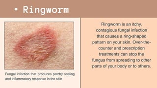 skin diseases, disorders, and prevention.pptx