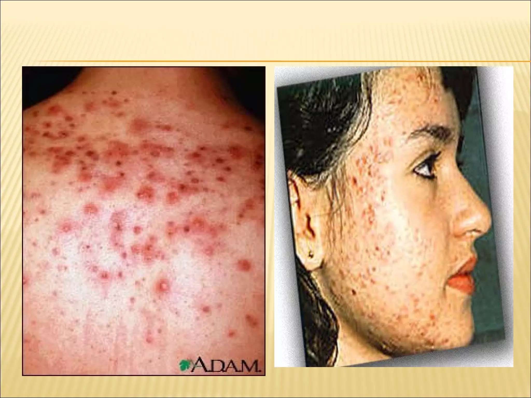 Skin diseases disorders conditions | PPT
