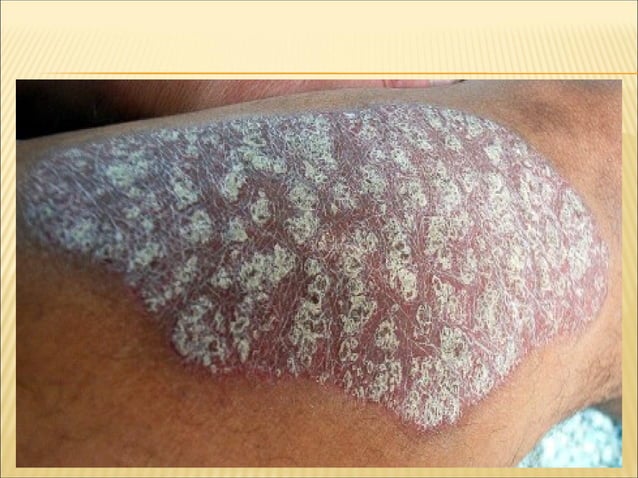 Skin diseases disorders conditions | PPT