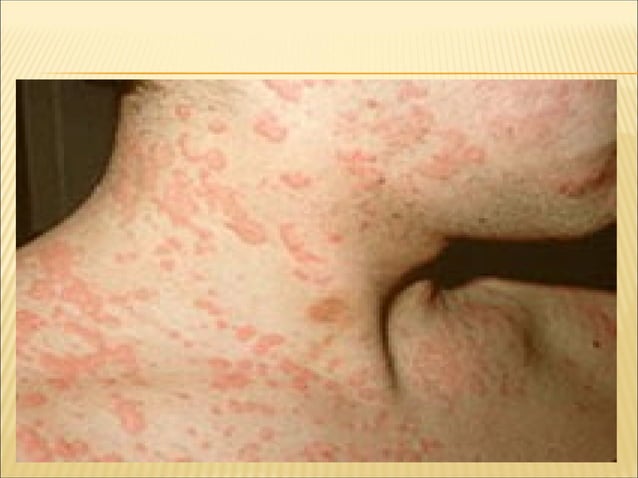 Skin diseases disorders conditions | PPT
