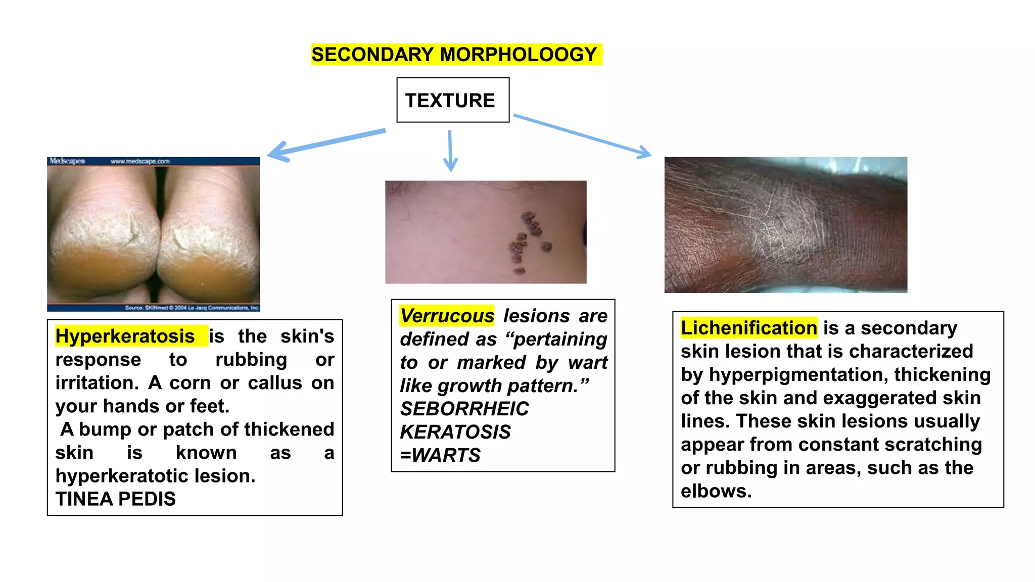 SKIN DISEASES LECTURE.pptx