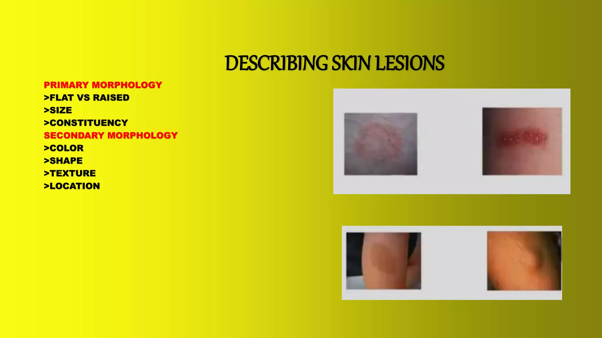 SKIN DISEASES LECTURE.pptx