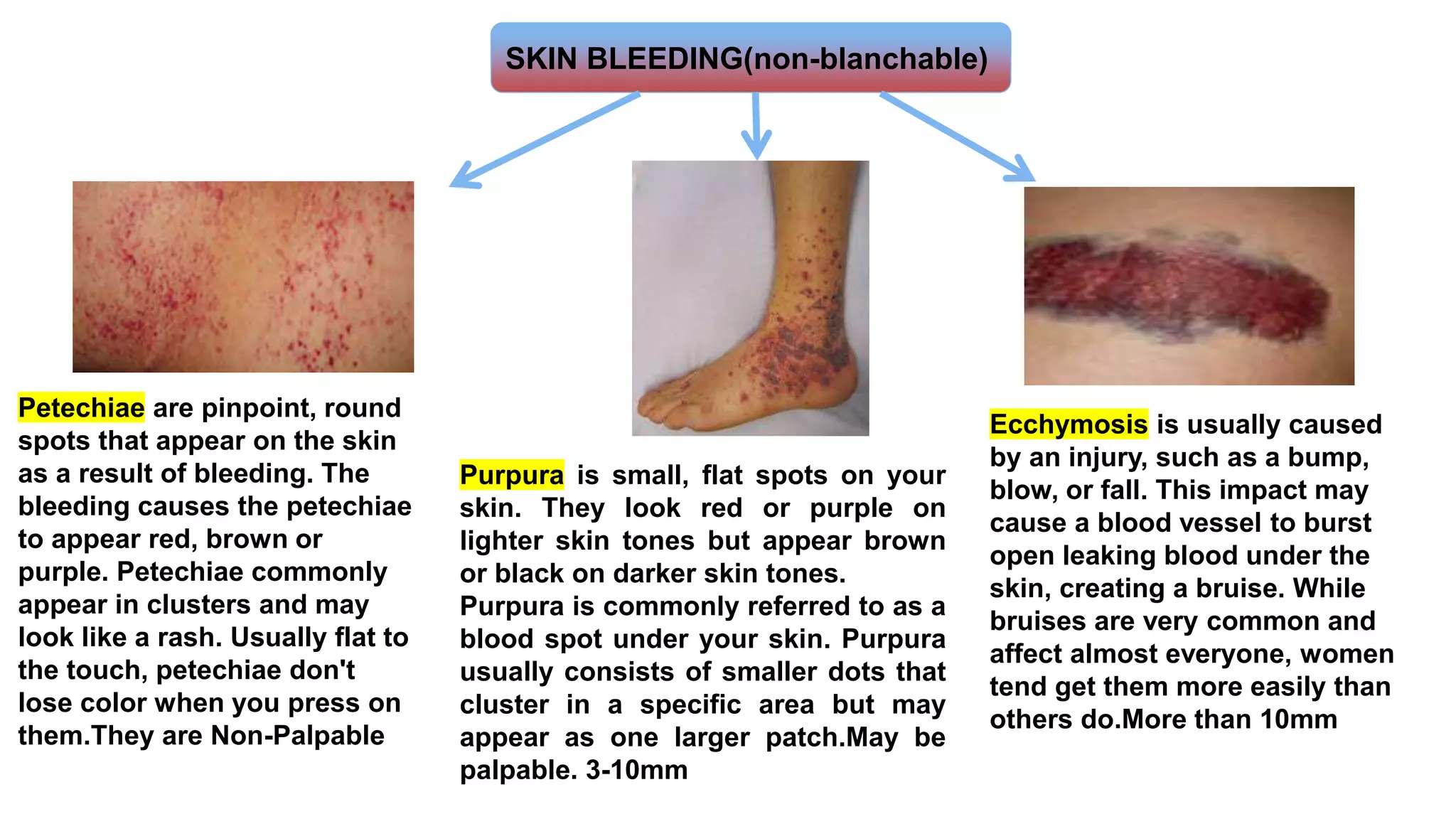 SKIN DISEASES LECTURE.pptx