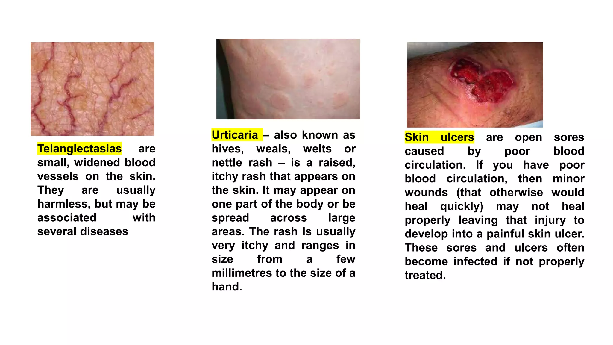 SKIN DISEASES LECTURE.pptx