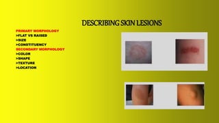 SKIN DISEASES LECTURE.pptx