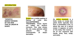 SKIN DISEASES LECTURE.pptx