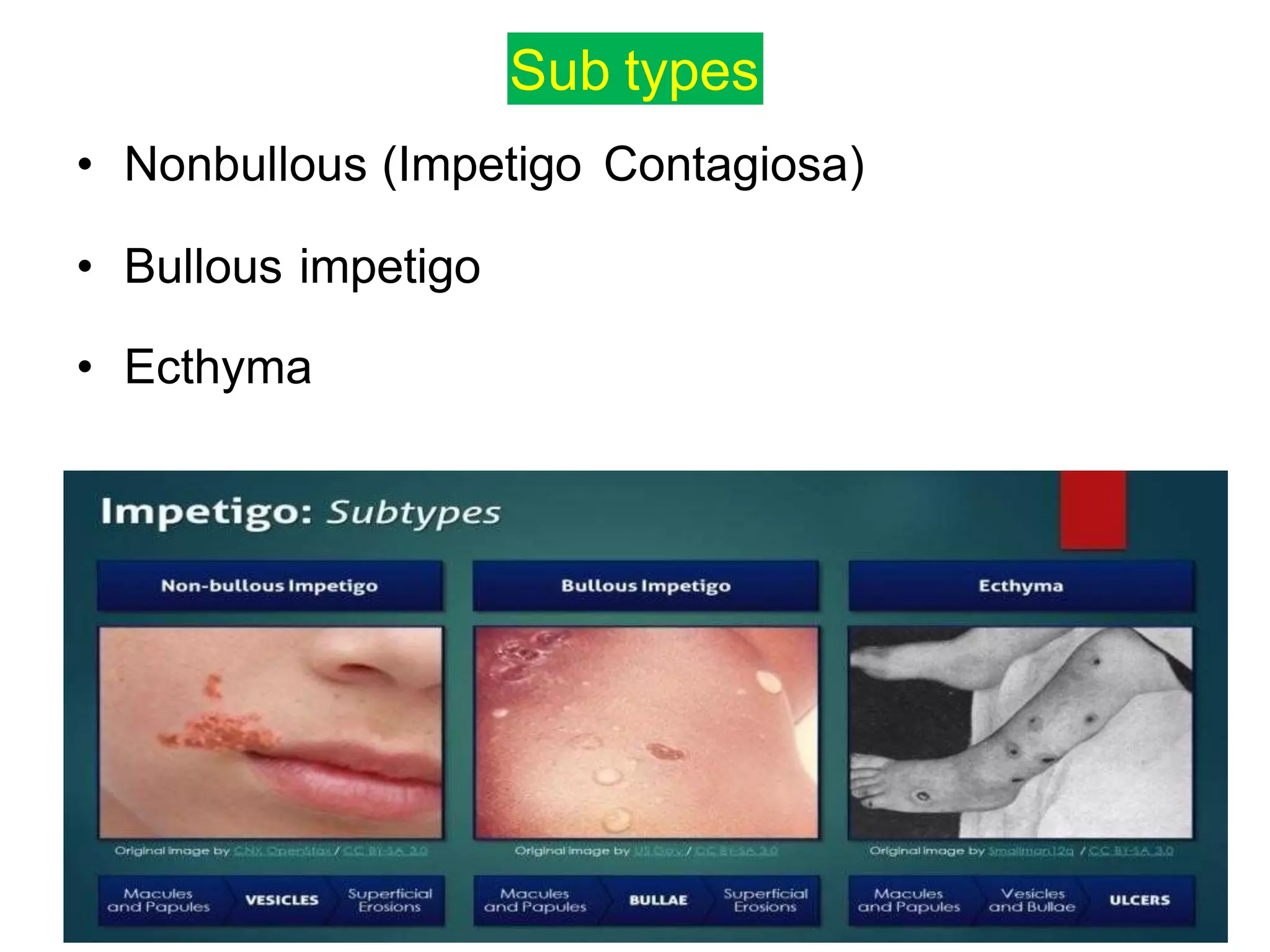 REVIEW OF SKIN DISORDER | PPTX