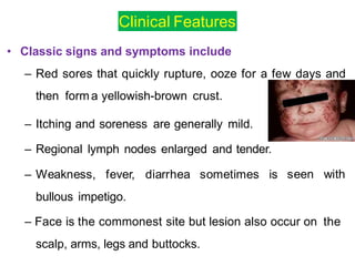 REVIEW OF SKIN DISORDER | PPTX