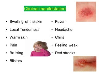 REVIEW OF SKIN DISORDER | PPTX