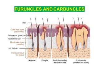 REVIEW OF SKIN DISORDER | PPTX