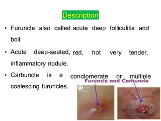 REVIEW OF SKIN DISORDER | PPTX