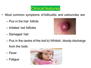 REVIEW OF SKIN DISORDER | PPTX