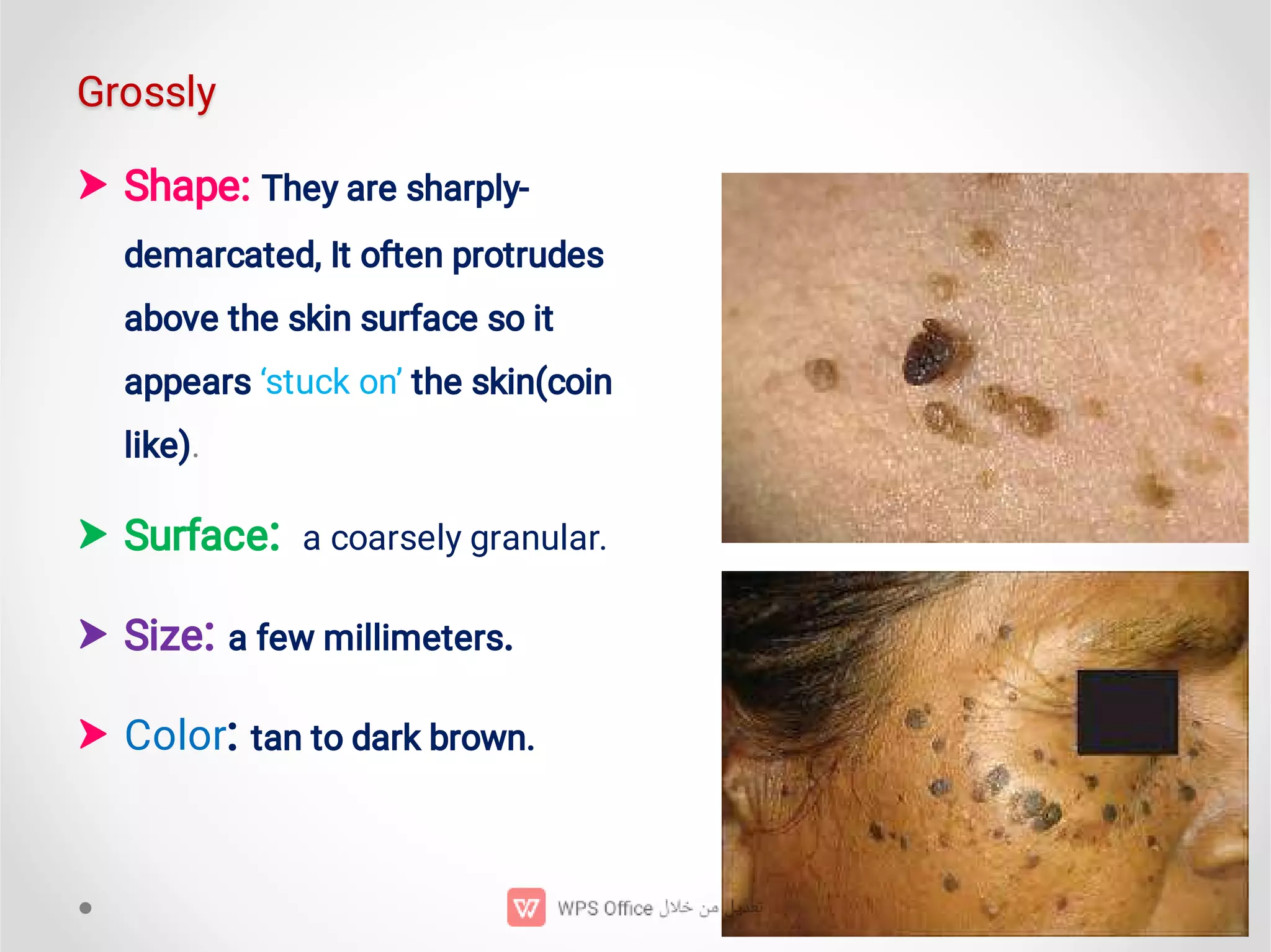 skin disorder .pdf